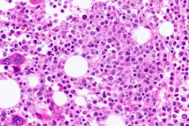 Apogenix - News, Articles etc. - European Pharmaceutical Review