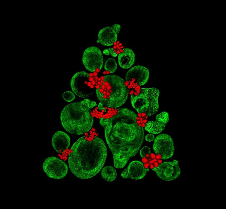 Images of Christmas wreath and Christmas tree reflect stem cells science
