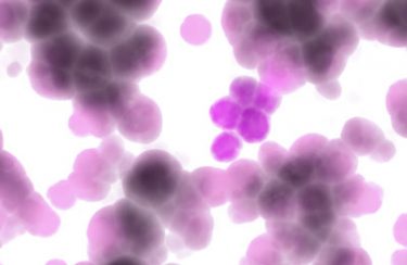 Arzerra improved median PFS by 54% in CLL