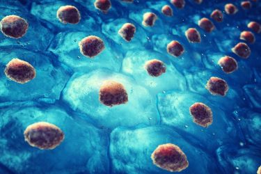 Combination treatment improves stem cell transplantation in MM