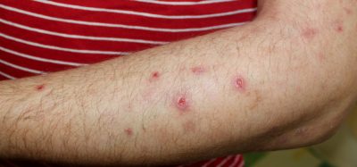 Rabbit pyrogen test to be replaced by European Pharmacopoeia